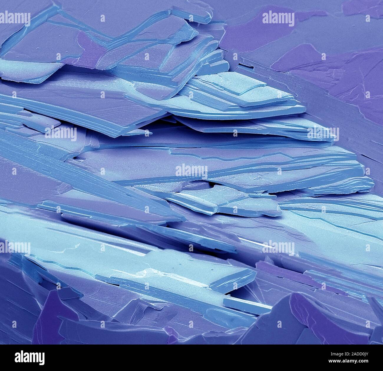 Gallstone crystals. Coloured scanning electron micrograph (SEM) of the ...