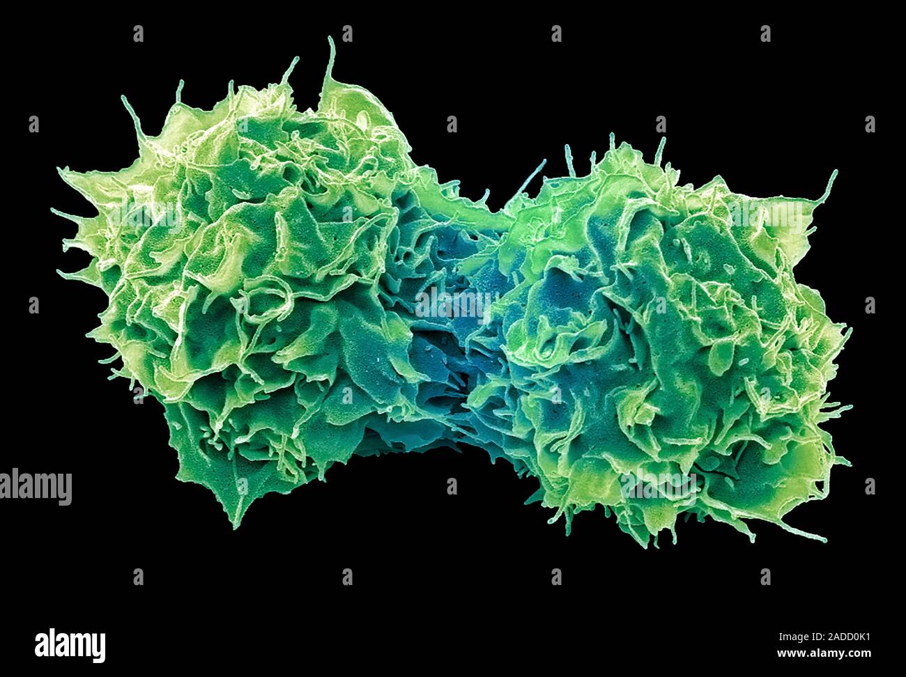 Dividing 293T cells in culture, coloured scanning electron micrograph ...