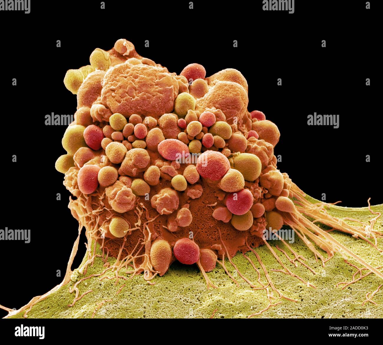 Apoptosis. Coloured scanning electron micrograph (SEM) of a brain ...