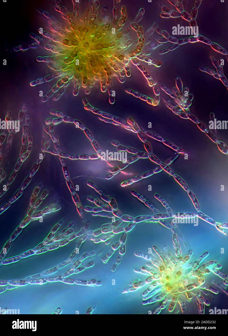 Batrachospermum sp. red algae, darkfield illuminated polarised light ...