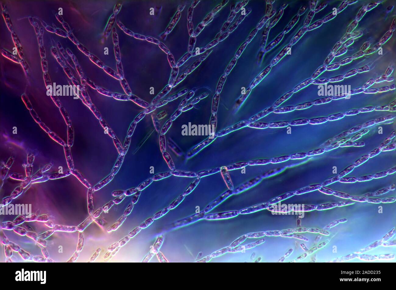 Batrachospermum sp. red algae, darkfield illuminated polarised light ...