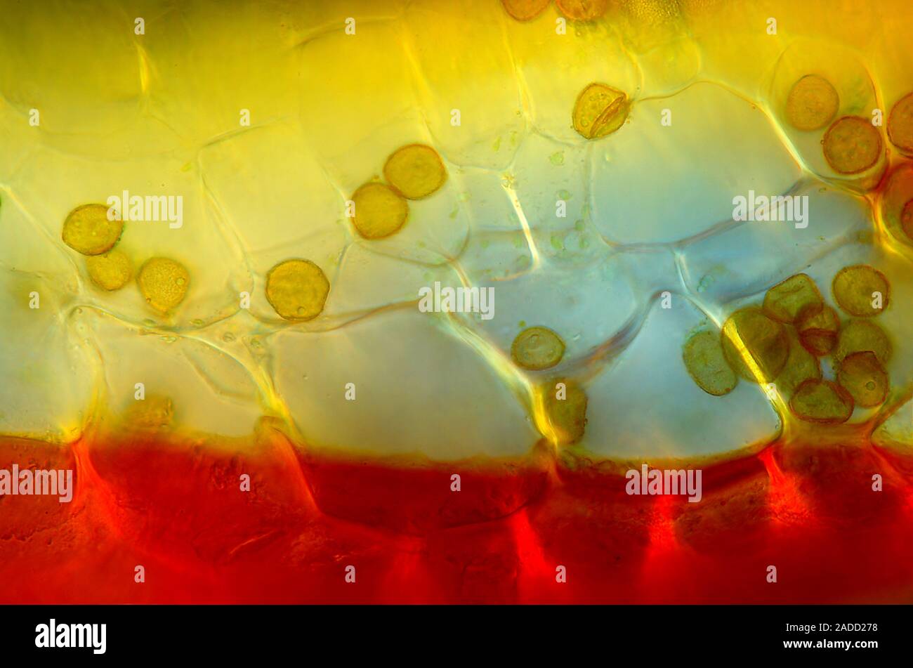 Moss spore capsule. Polarised light micrograph of a transverse section ...
