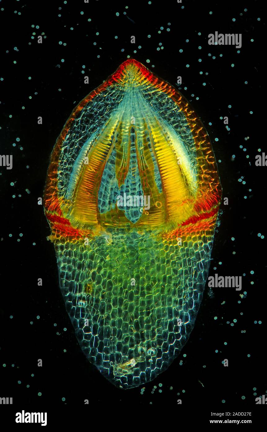 Moss spore capsule. Darkfield illuminated polarised light micrograph of ...