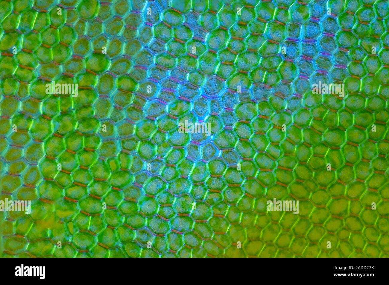 Liverwort Leaf Polarised Light Micrograph Of A Section Through A Leaf From A Liverwort Plant