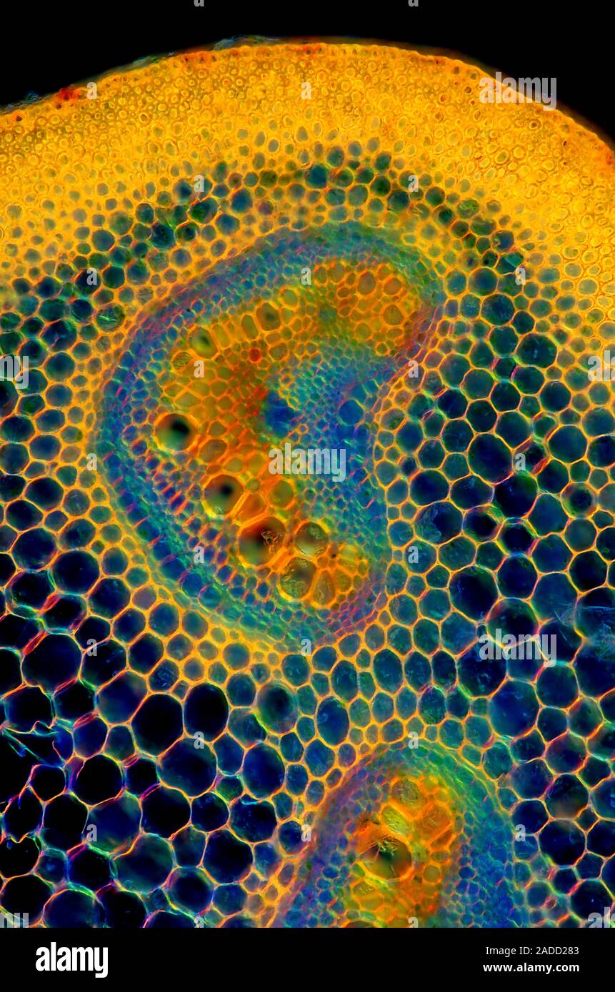 Fern stem. Darkfield illuminated polarised light micrograph of a ...