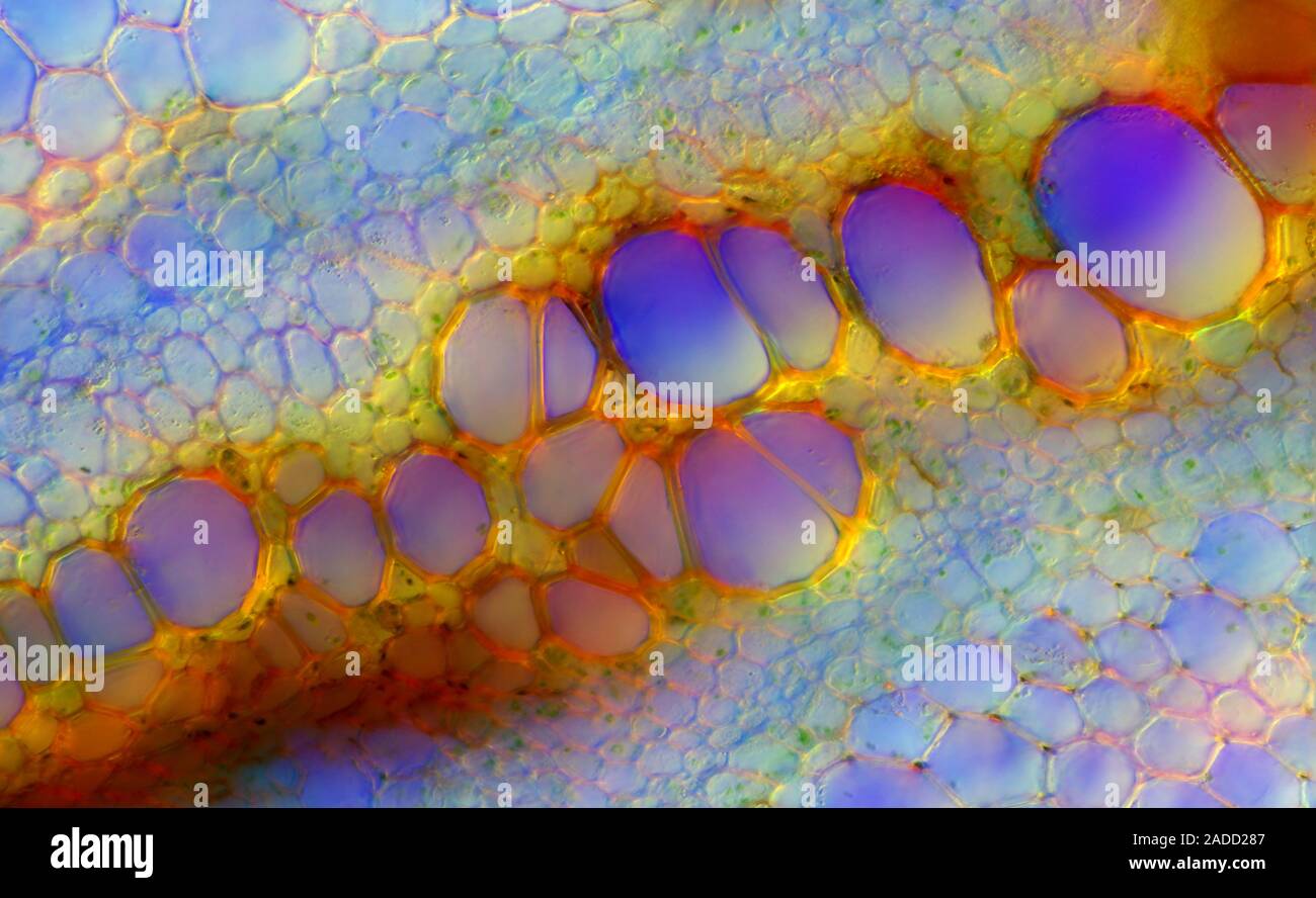 Fern stem. Rheinberg illuminated polarised light micrograph of a ...