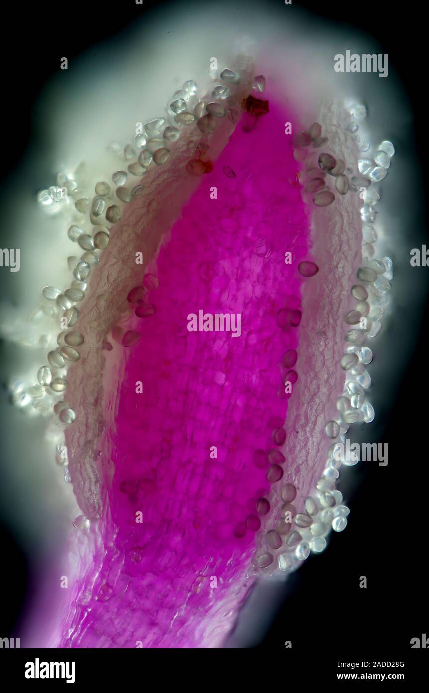 Liverleaf (Hepatica sp.) anther. Darkfield illuminated light micrograph ...