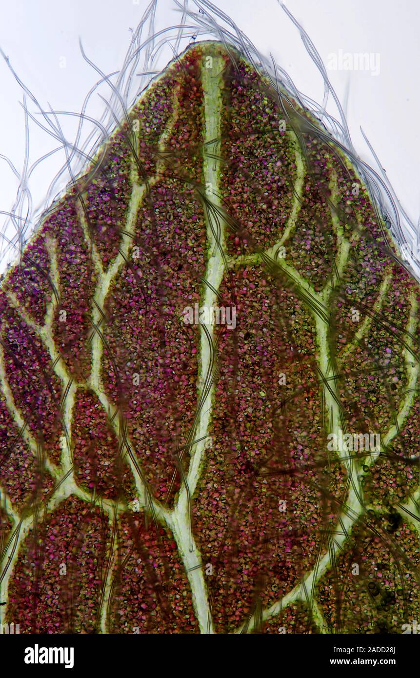 Liverleaf (Hepatica sp.) bract. Brightfield illuminated light ...