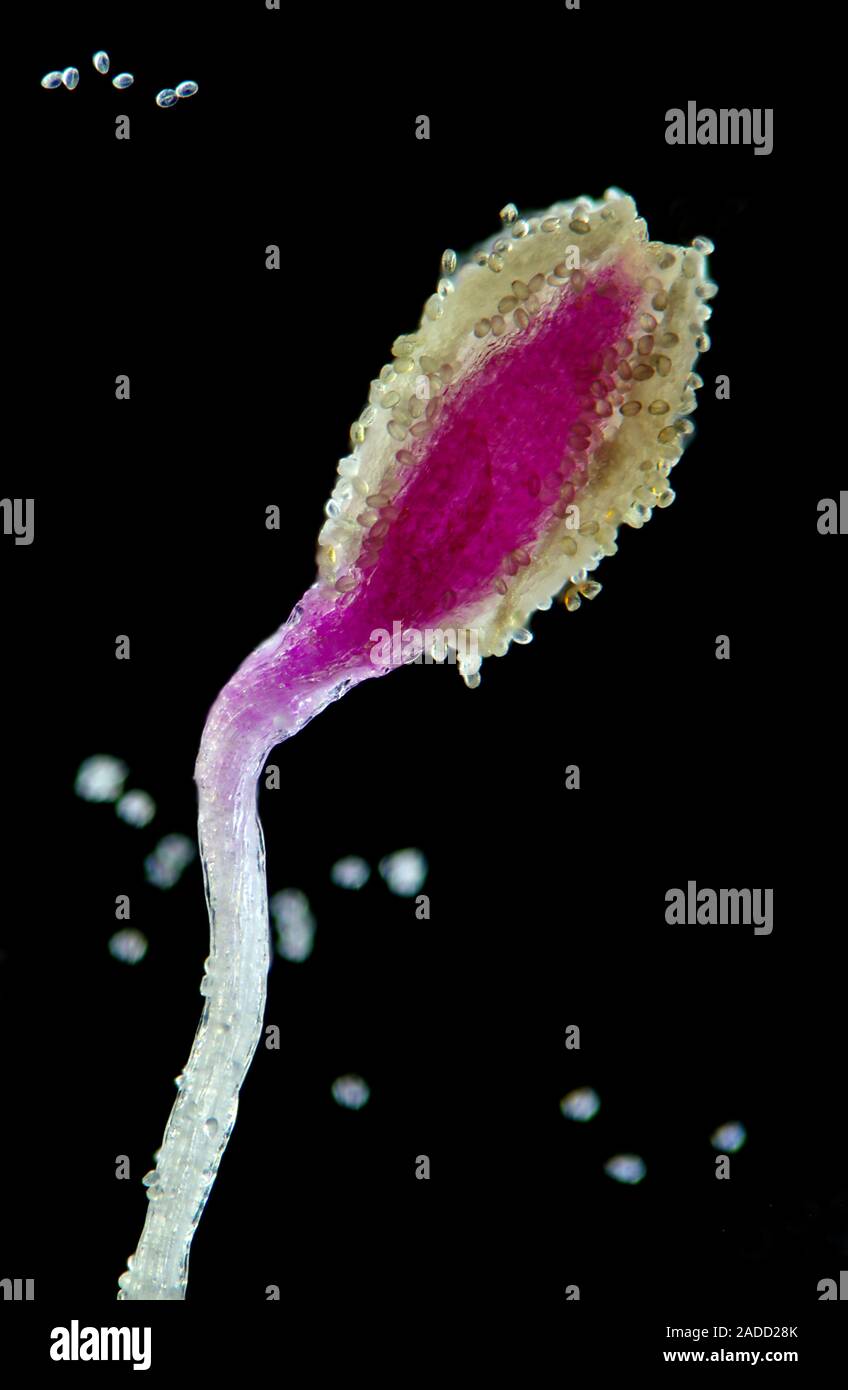 Liverleaf (Hepatica sp.) anther. Darkfield illuminated light micrograph ...