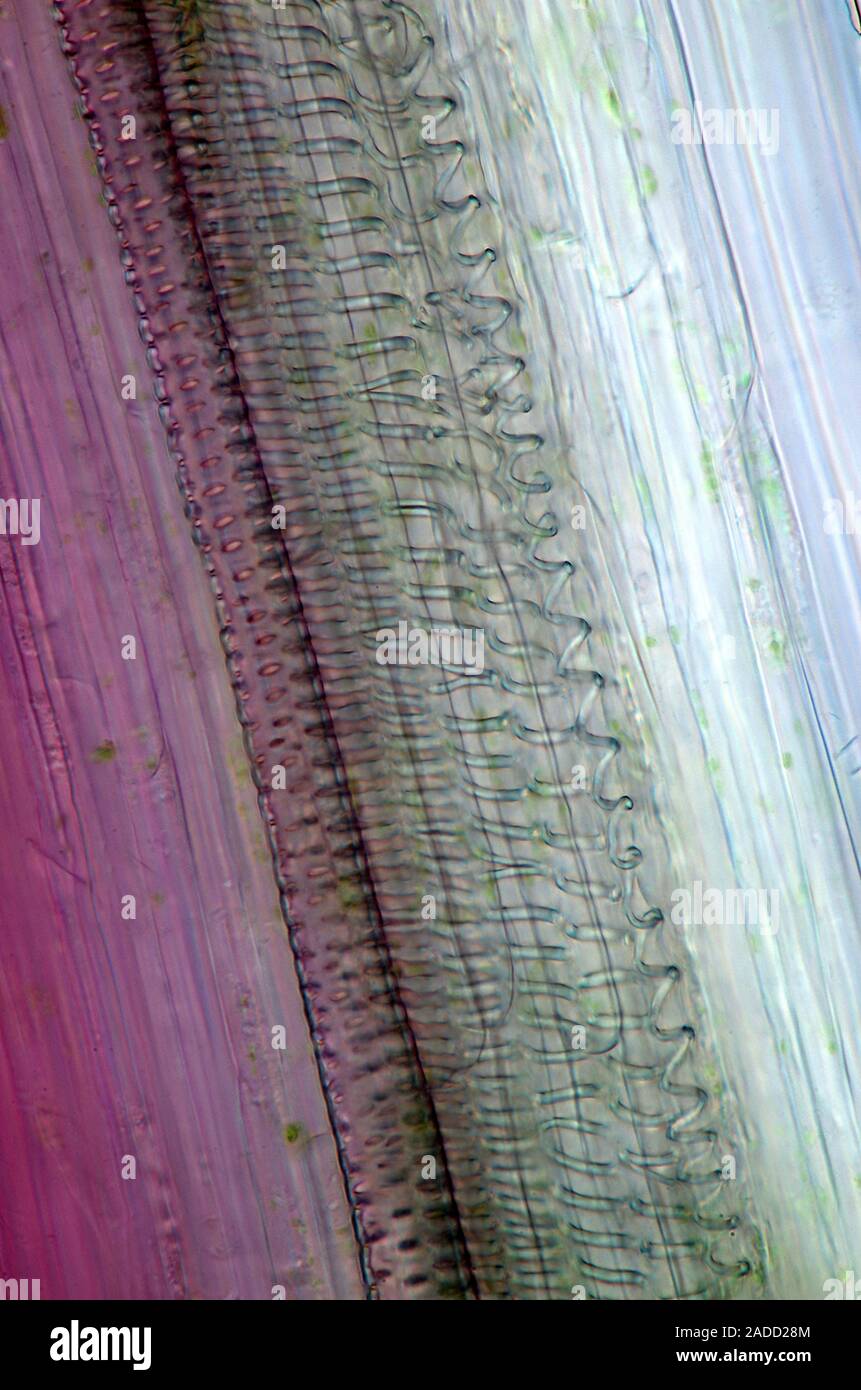 Liverleaf (Hepatica sp.) stem. Brightfield illuminated light micrograph ...