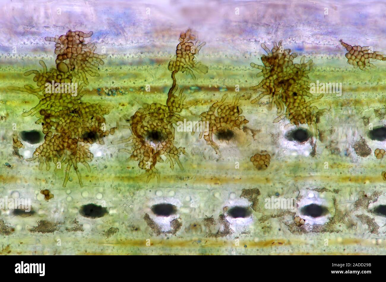 Infected pine (Pinus sp.) needle. Polarised light micrograph of a ...