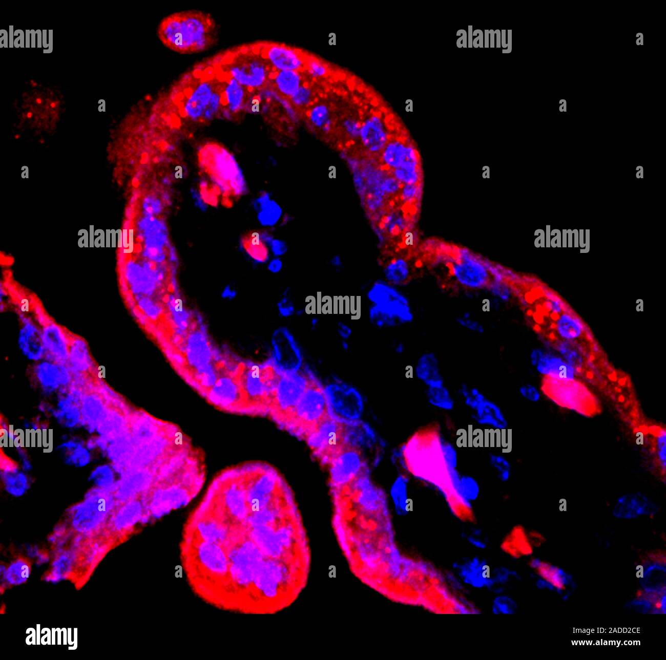 Trophoblasts. Fluorescence deconvolution micrograph of trophoblast ...