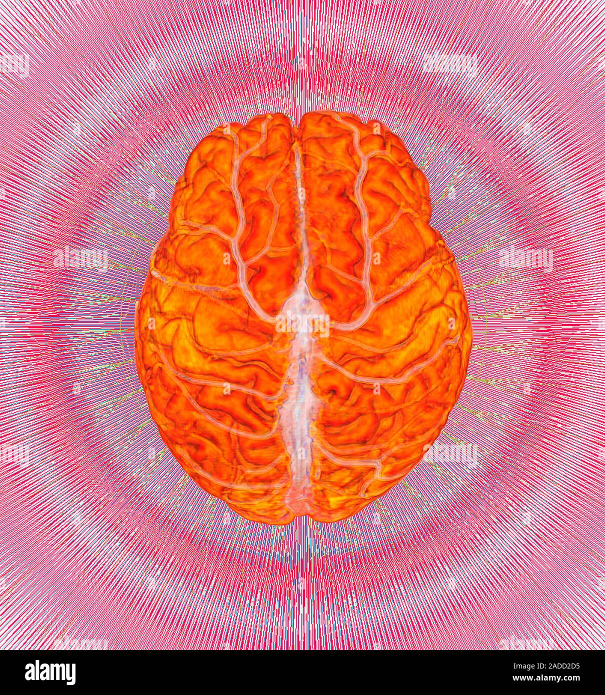 Human brain and abstract background, coloured 3D magnetic resonance imaging (MRI) scan. The ...