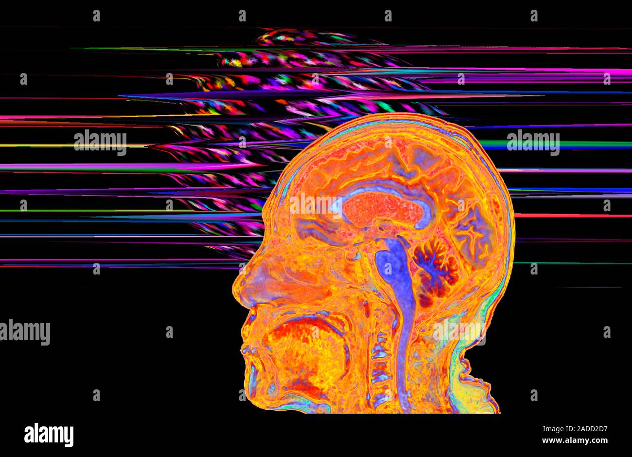 Human brain and abstract background, coloured sagittal magnetic resonance imaging (MRI) scan ...