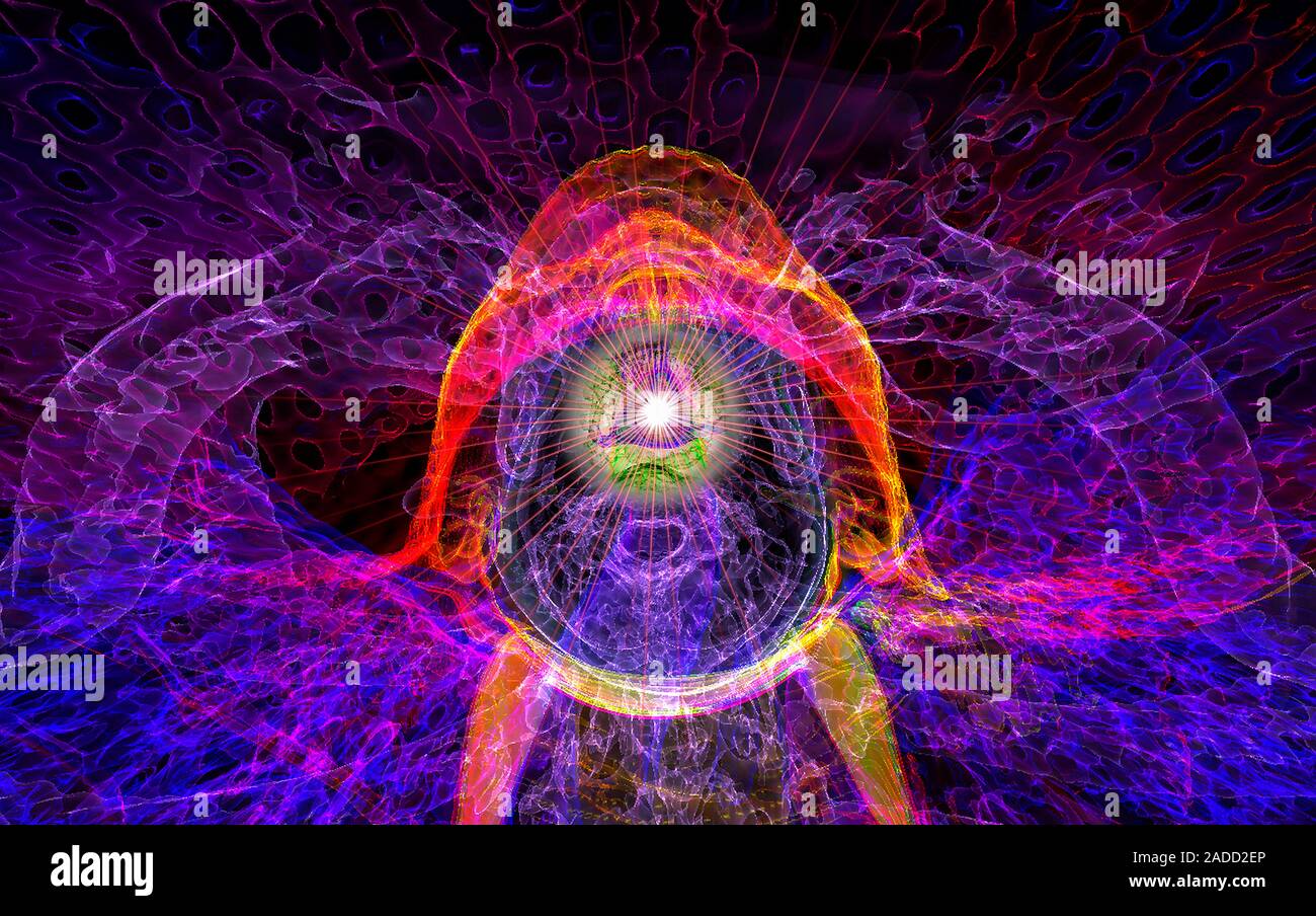 Patient wearing radiotherapy mask. Coloured 3D computed tomography (CT ...