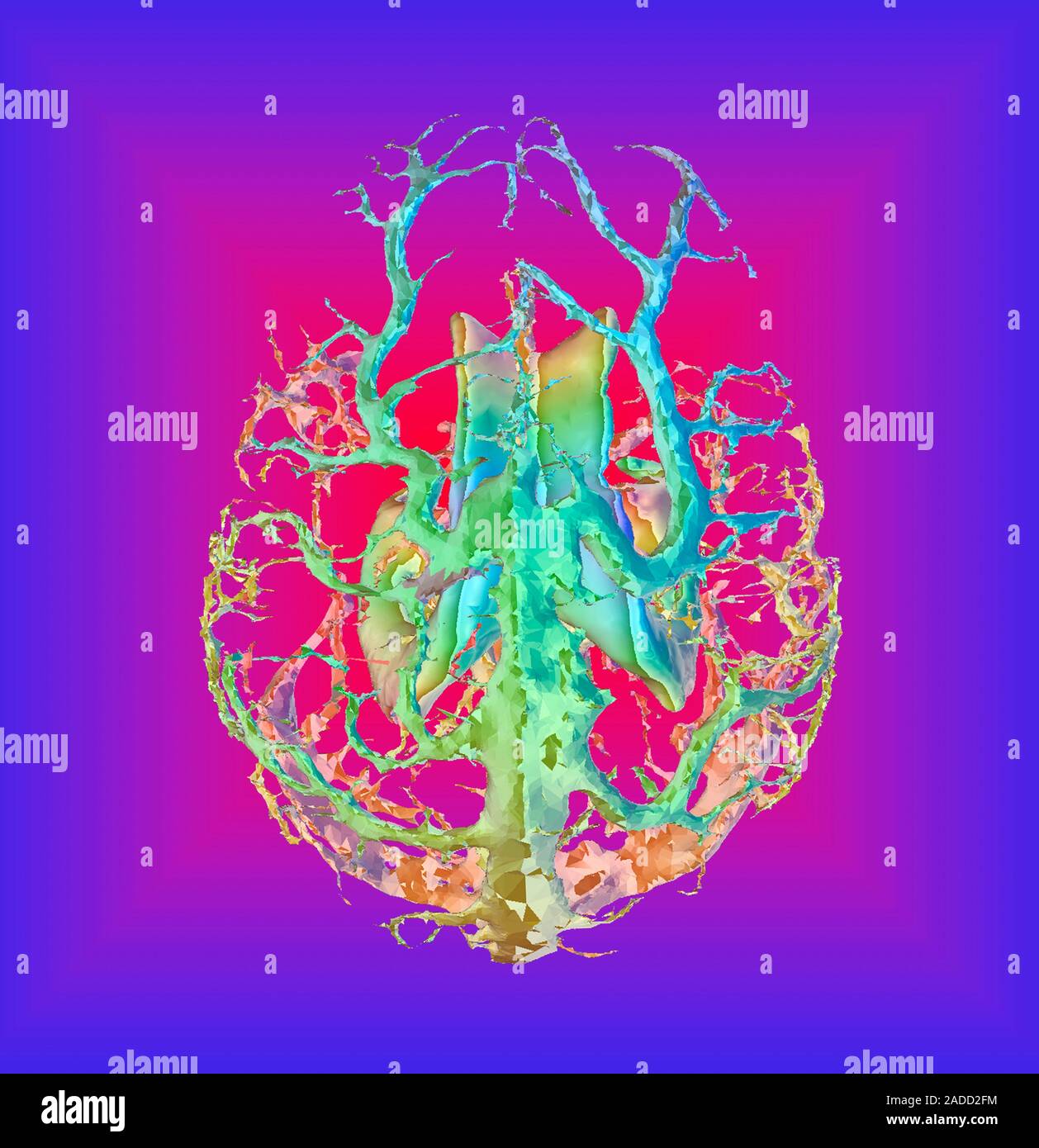 Human brain ventricles and veins, coloured 3D magnetic resonance imaging (MRI) scan. The front ...