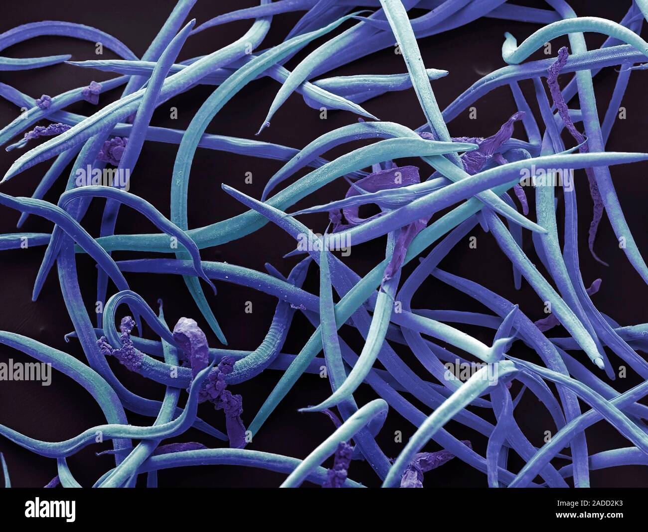 Nematodes. Coloured scanning electron micrograph (SEM) of ...