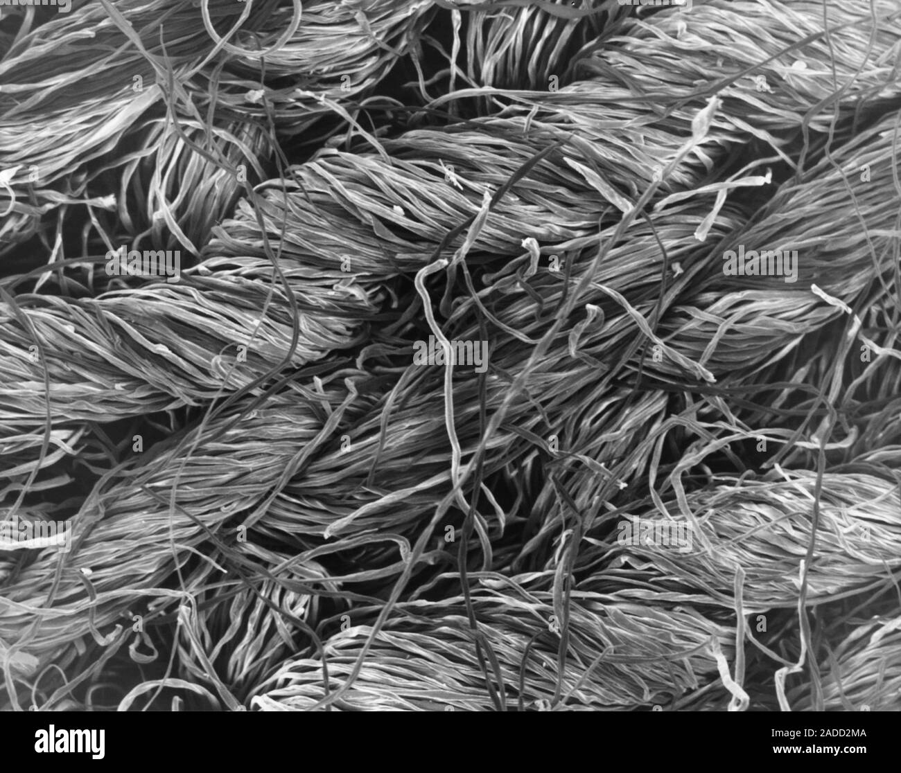 Scanning electron micrograph of cotton (100%) muslin fabric. Cotton is ...