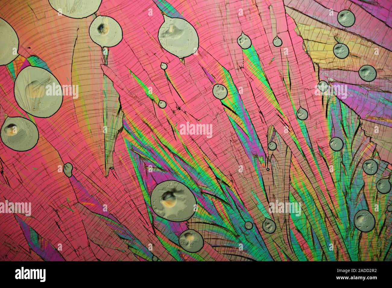 Polarised light micrograph of dopamine (3,4-dihydroxyphenethylamine ...