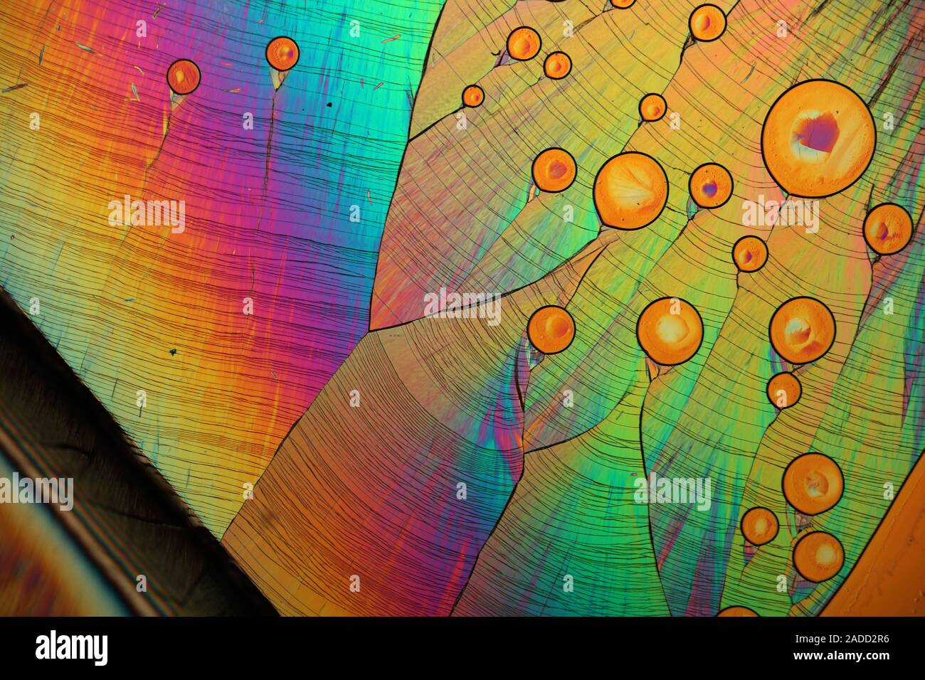 Polarised light micrograph of dopamine (3,4-dihydroxyphenethylamine ...