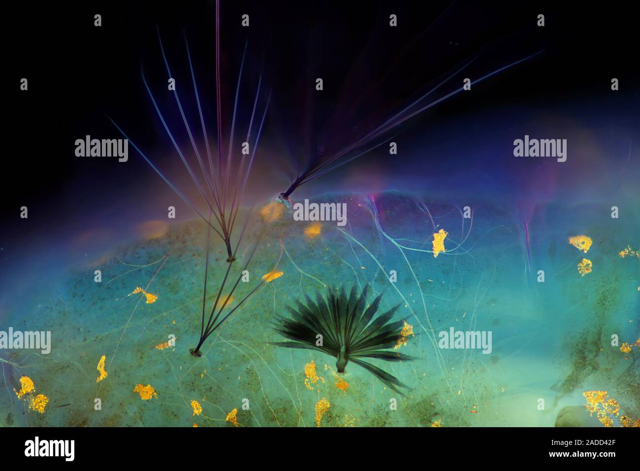 Fly larva respiratory structure. Polarized light micrograph of bristles ...