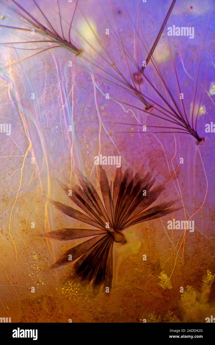 Fly larva respiratory structure. Polarized light micrograph of bristles ...