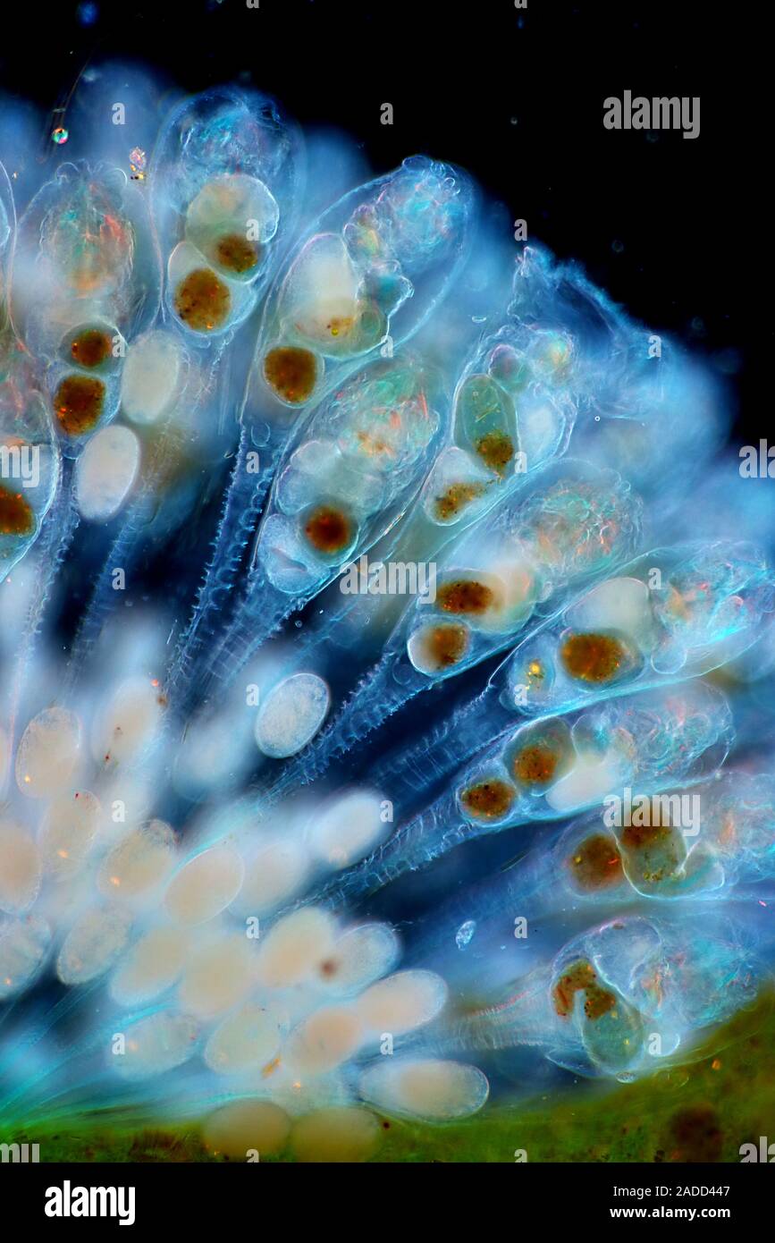 Colonial rotifers (Lacinularia sp.), polarized light micrograph ...