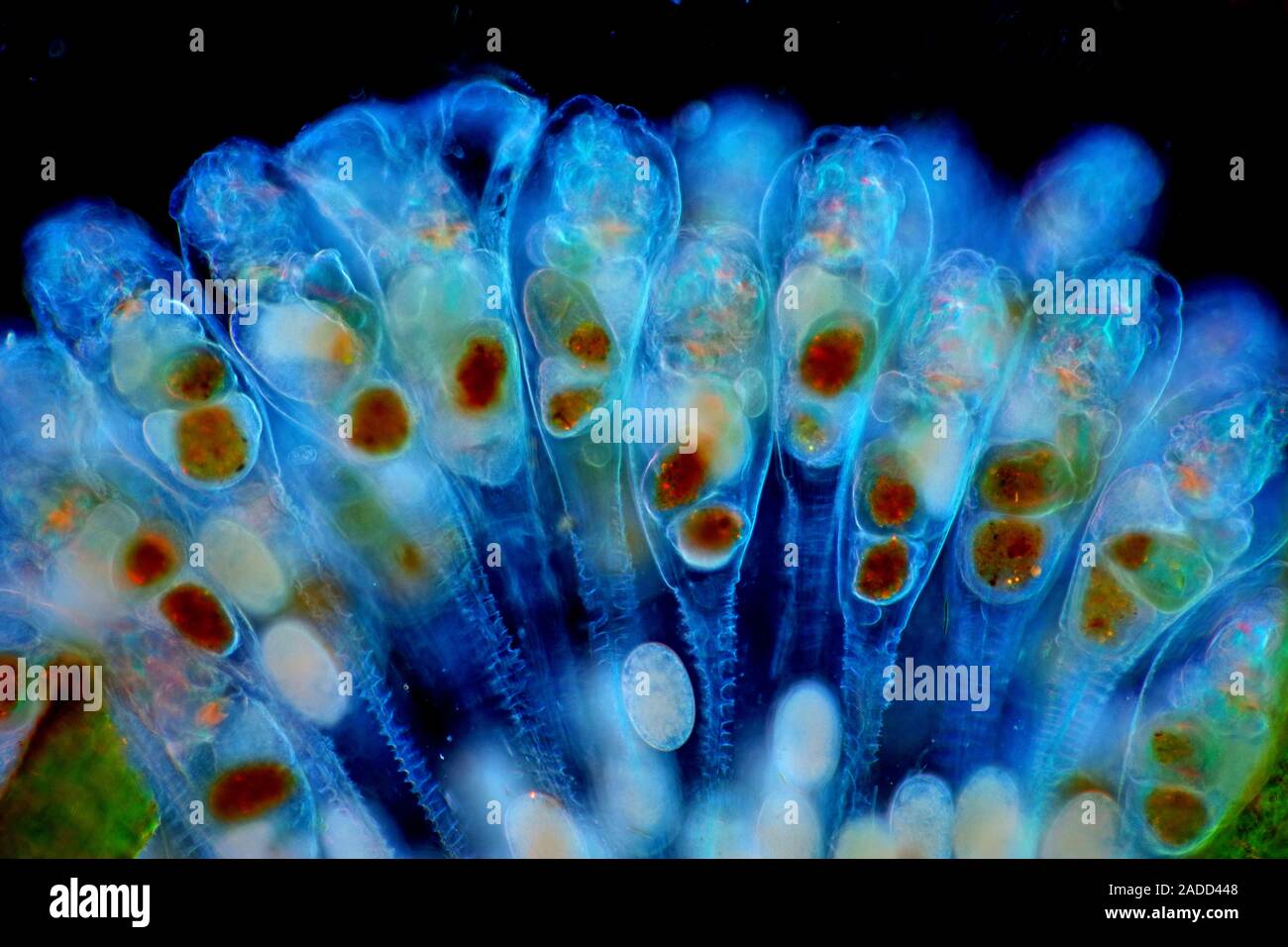 Colonial rotifers (Lacinularia sp.), polarized light micrograph ...