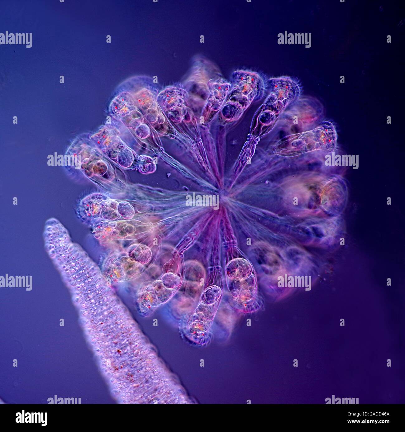 Colonial rotifers and hydra tentacle, polarized light micrograph. These ...