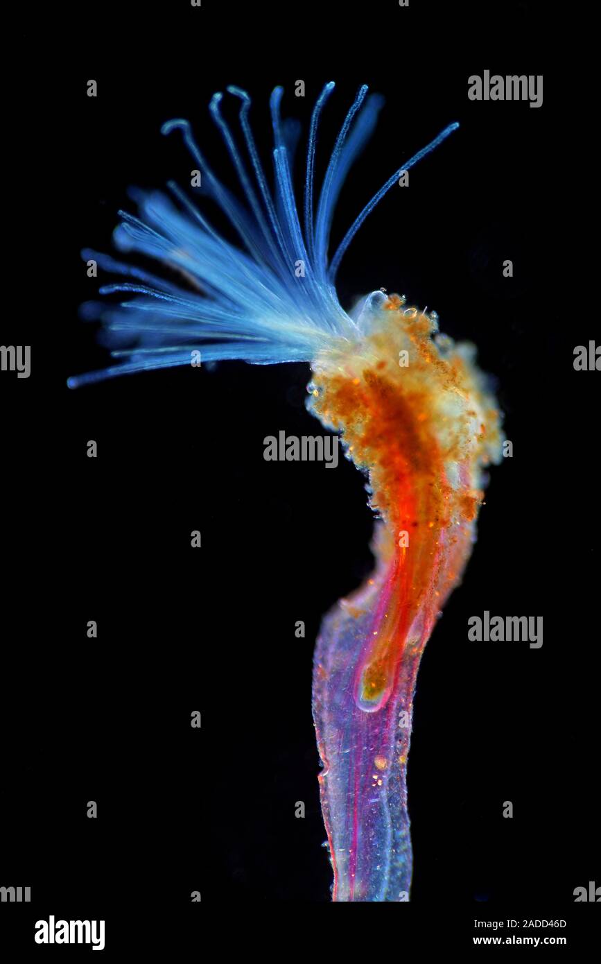 Bryozoan, polarized light micrograph. Bryozoans are tiny filter-feeding ...