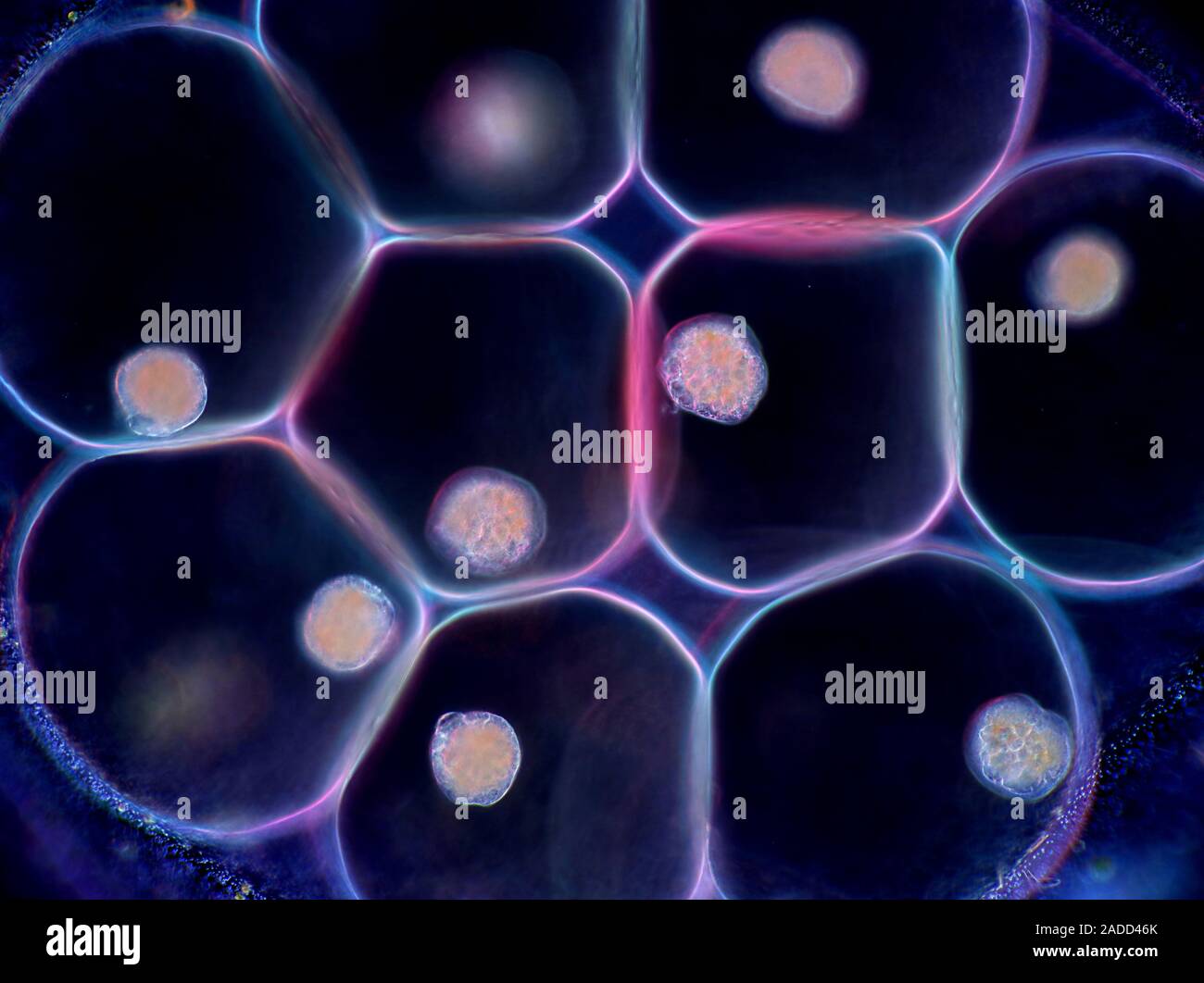 Snail eggs and embryos, polarized light micrograph. These are ...