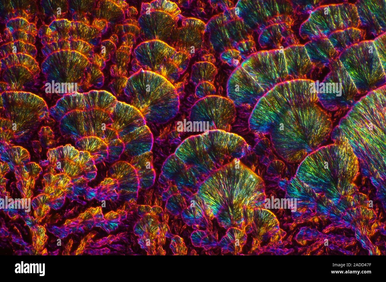 Vitamin C crystals. Polarized light micrograph of crystals of vitamin C ...