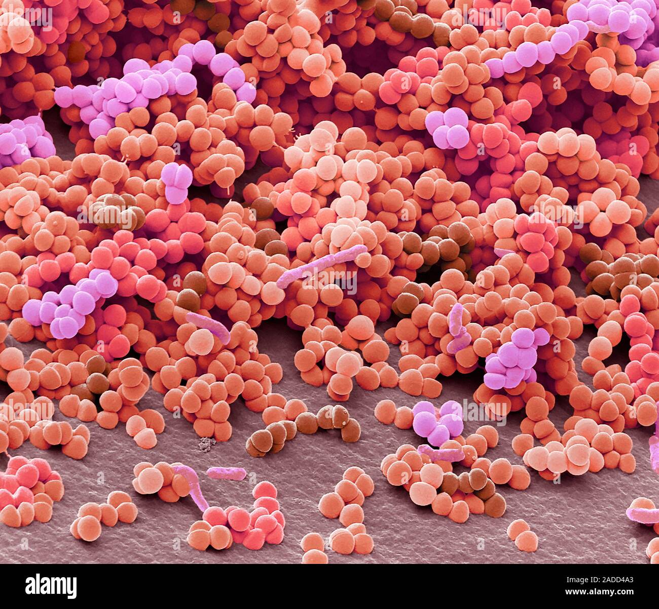 Folliculitis. Coloured scanning electron micrograph (SEM) of bacteria ...