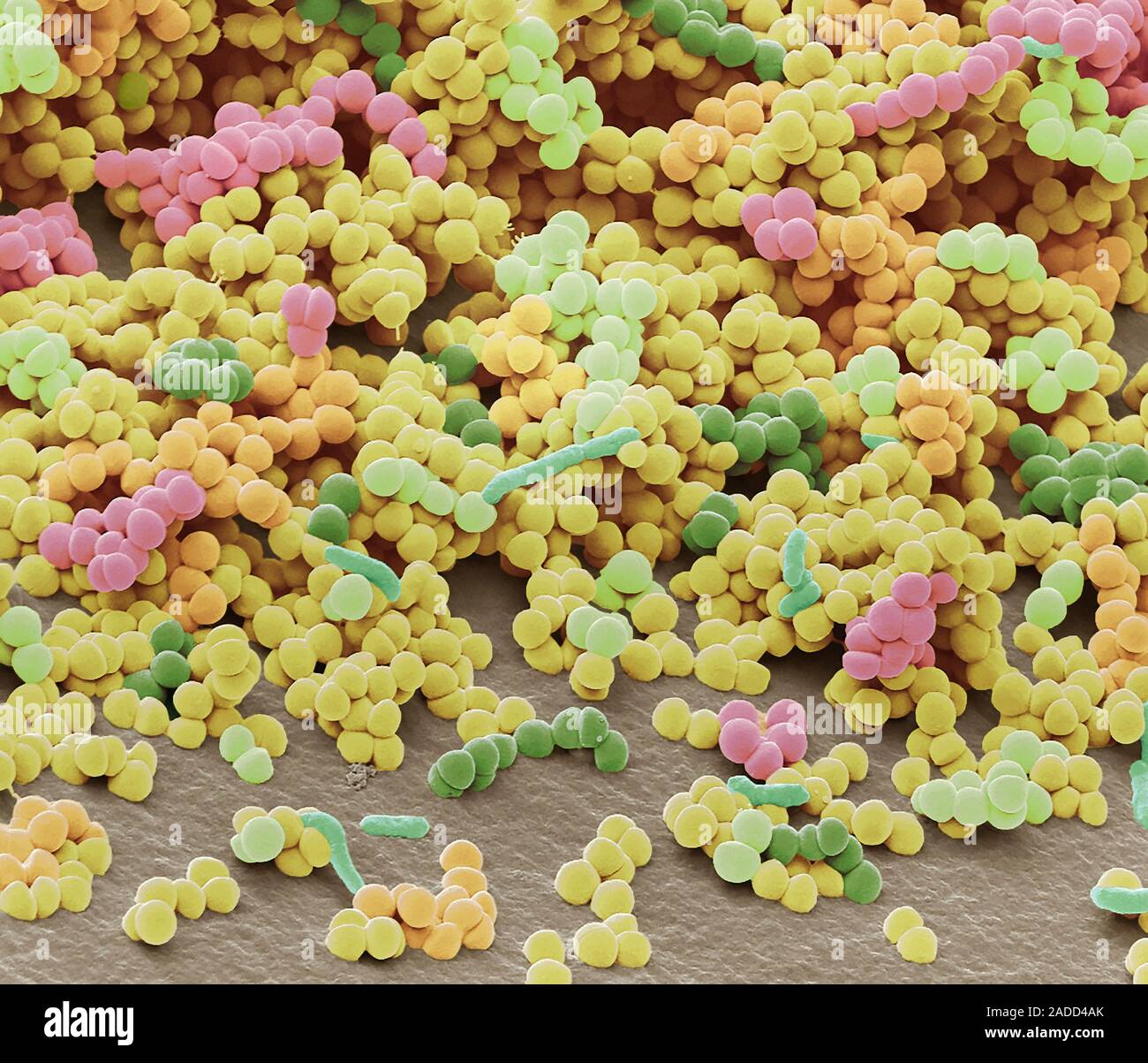 Folliculitis. Coloured scanning electron micrograph (SEM) of bacteria ...
