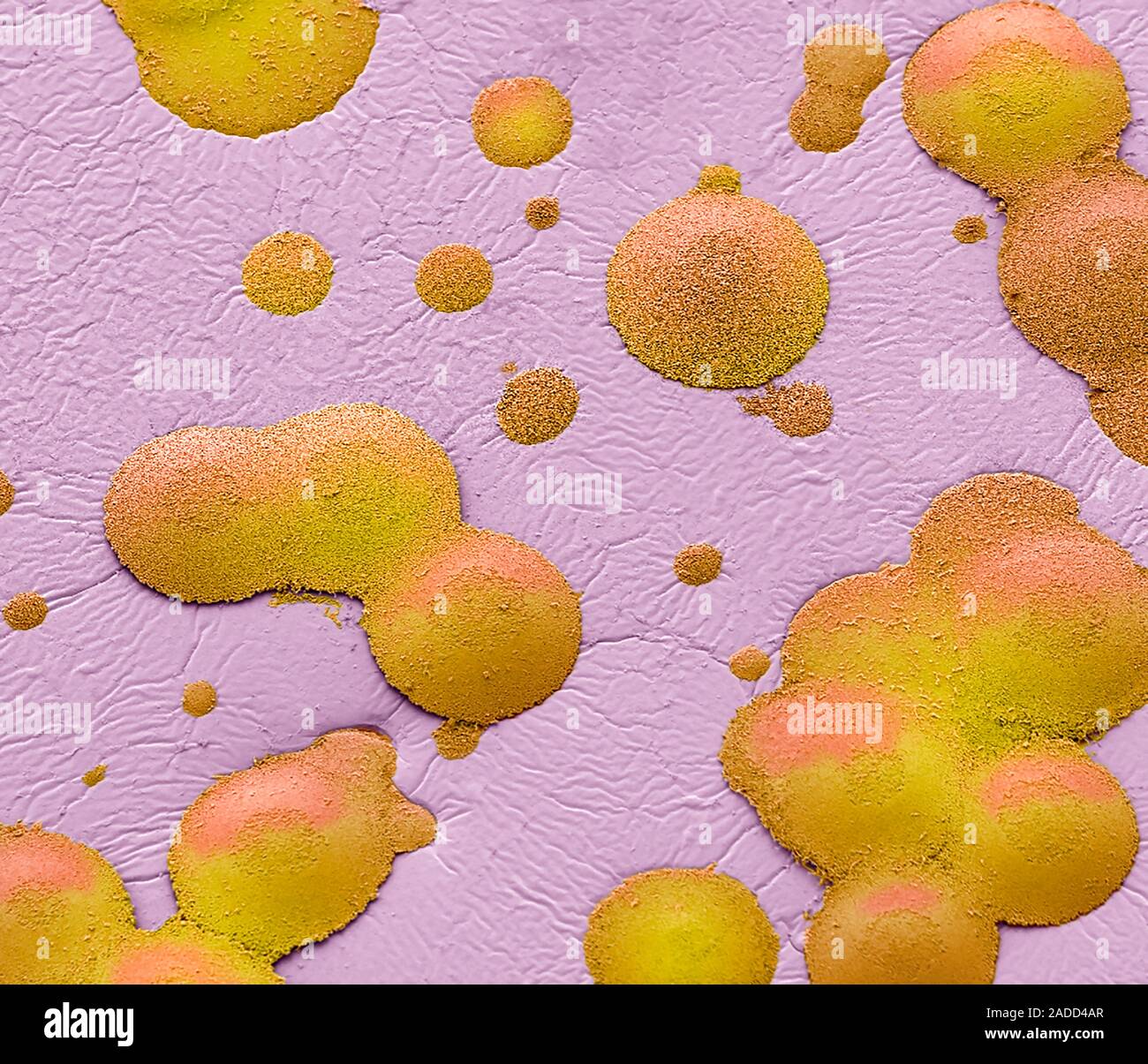 Sputum. Scanning electron micrograph (SEM) of a bacterial culture from ...
