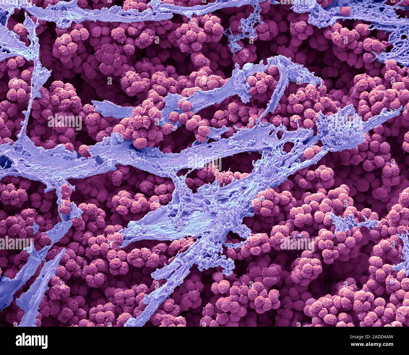 Sputum. Scanning electron micrograph (SEM) of a bacterial culture from ...