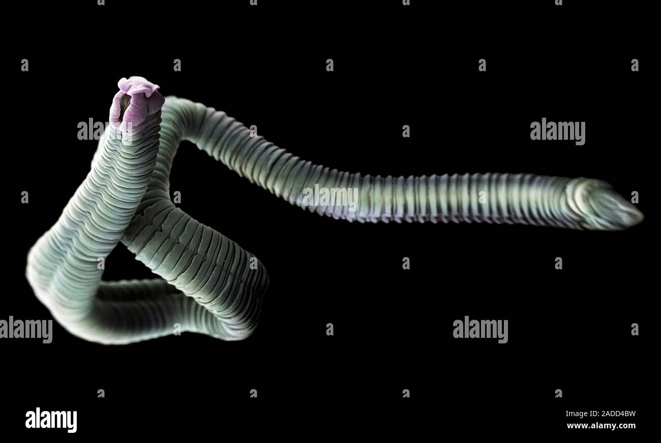 Coloured scanning electronmicrograph (SEM) of a tapeworm (Eubothrium ...