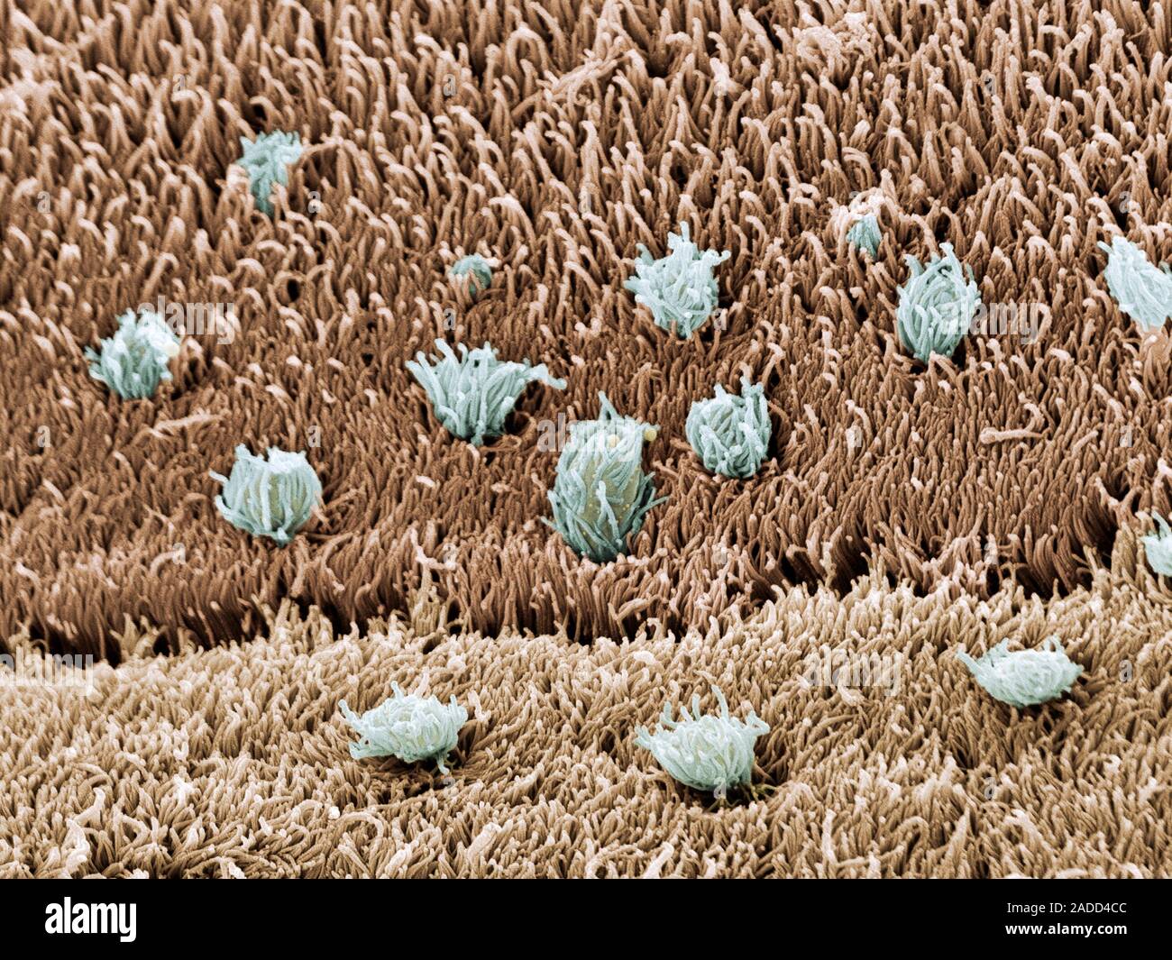 Coloured scanning electronmicrograph (SEM) of the surface of a tapeworm ...