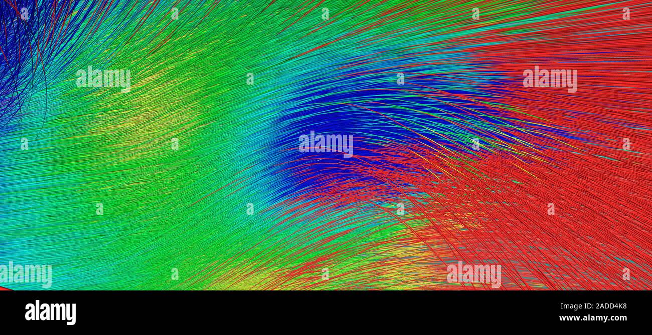 Diffusion tensor imaging (DTI) scan. A close-up look into the ...