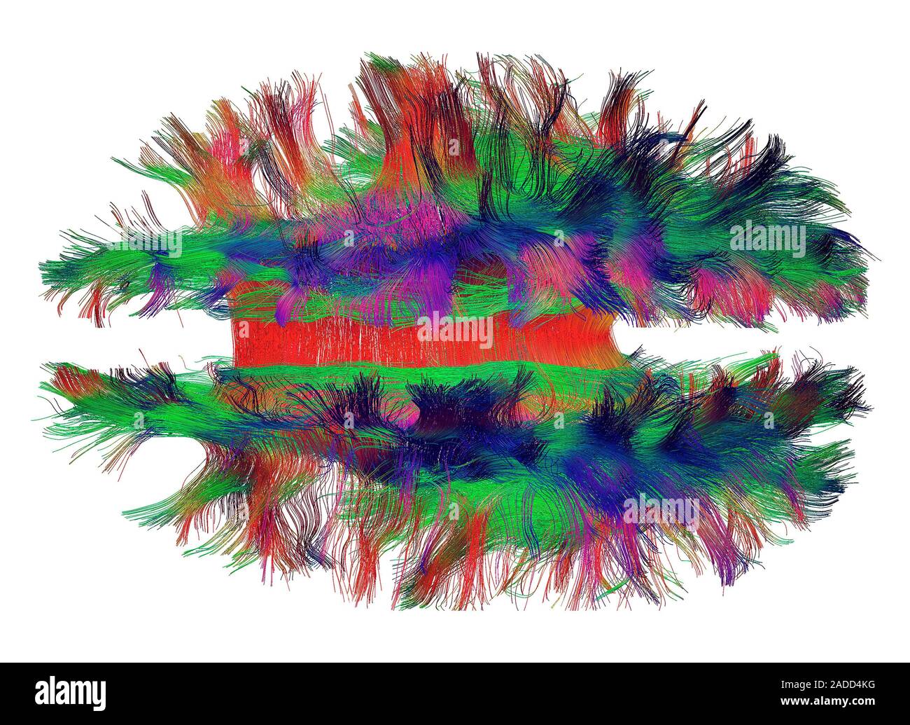 Diffusion Tensor Imaging Dti Scan Reconstructed Brain - vrogue.co Diffusion Tensor Imaging Dti Scan Reconstructed Brain - vrogue.co