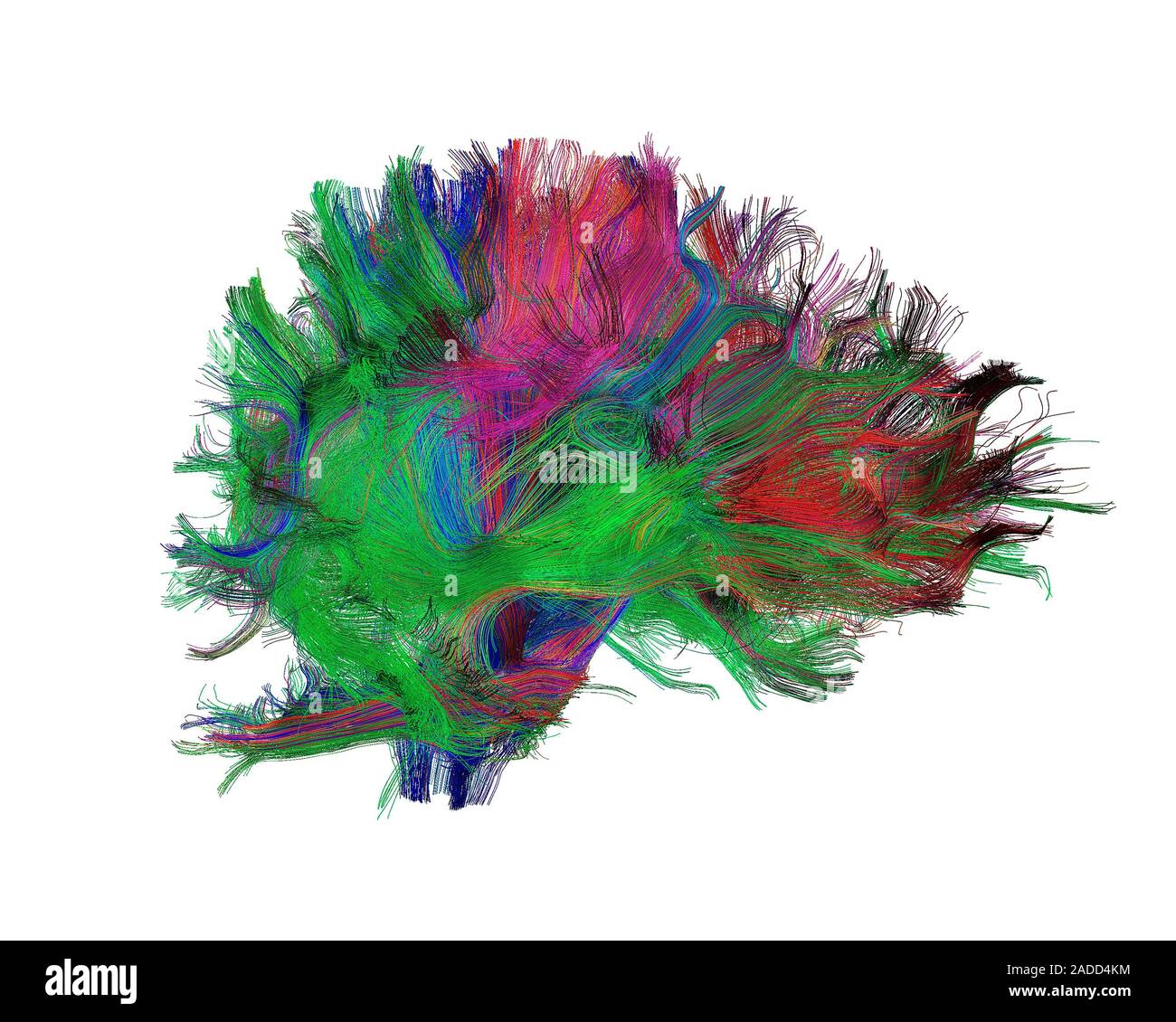 Diffusion tensor imaging (DTI) scan. Reconstructed brain white matter ...