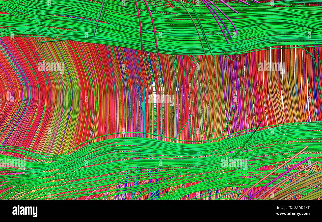 Diffusion tensor imaging (DTI) scan. Reconstructed brain white matter ... Diffusion tensor imaging (DTI) scan. Reconstructed brain white matter ...