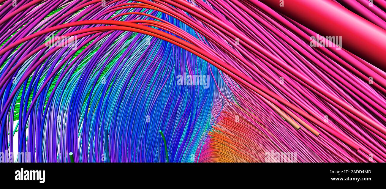 Diffusion tensor imaging (DTI) scan. Reconstructed brain white matter ... Diffusion tensor imaging (DTI) scan. Reconstructed brain white matter ...