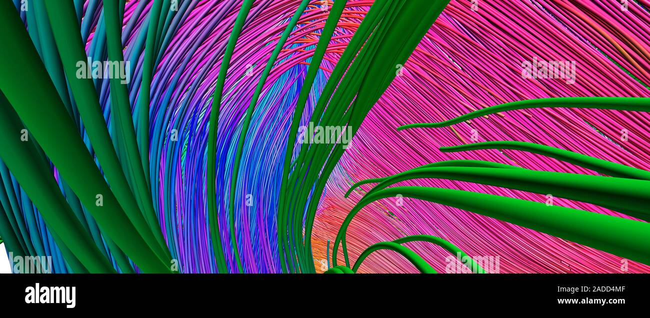 Diffusion tensor imaging (DTI) scan. Reconstructed brain white matter fibres of the corpus ...