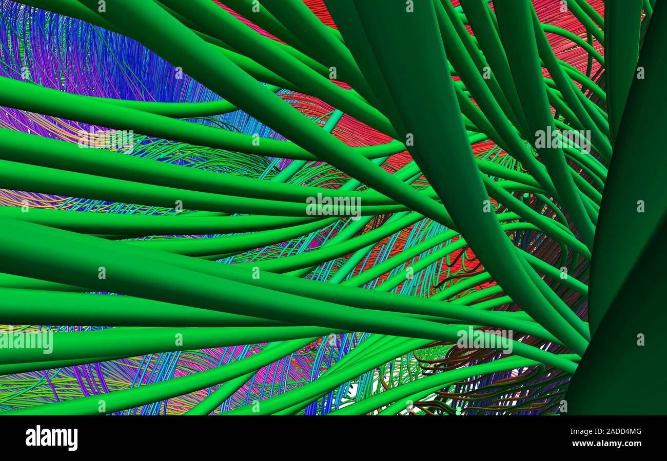 Diffusion tensor imaging (DTI) scan. Shown are the reconstructed white ...