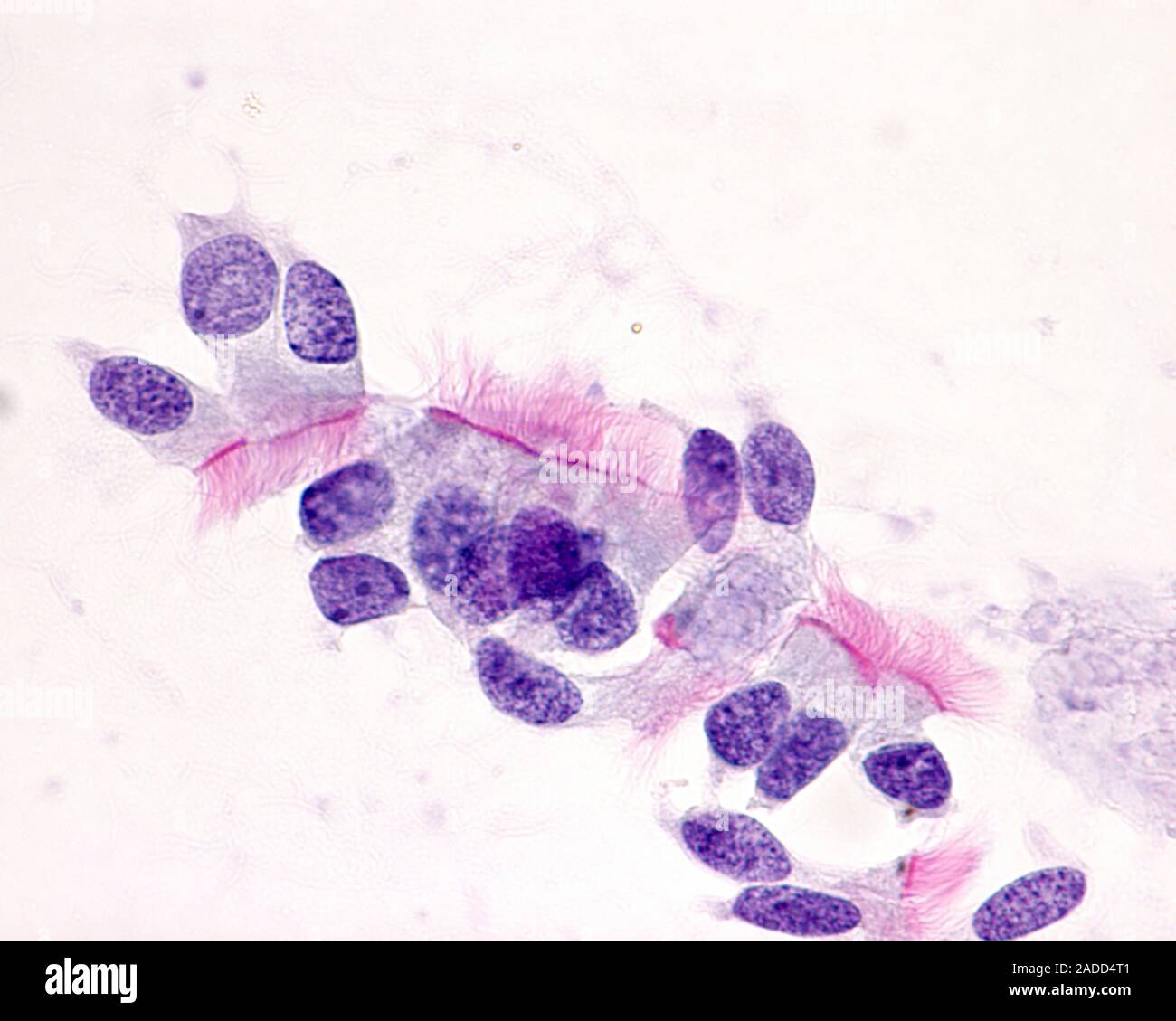High magnification light micrograph of ciliated epithelial cells ...
