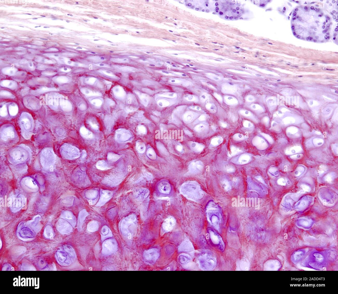 Light micrograph of elastic cartilage of a human epiglottis stained ...