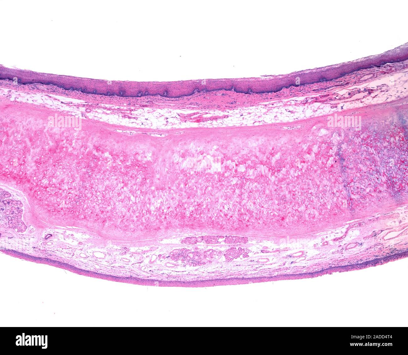 Light micrograph of the human epiglottis. At top is the lingual surface ...