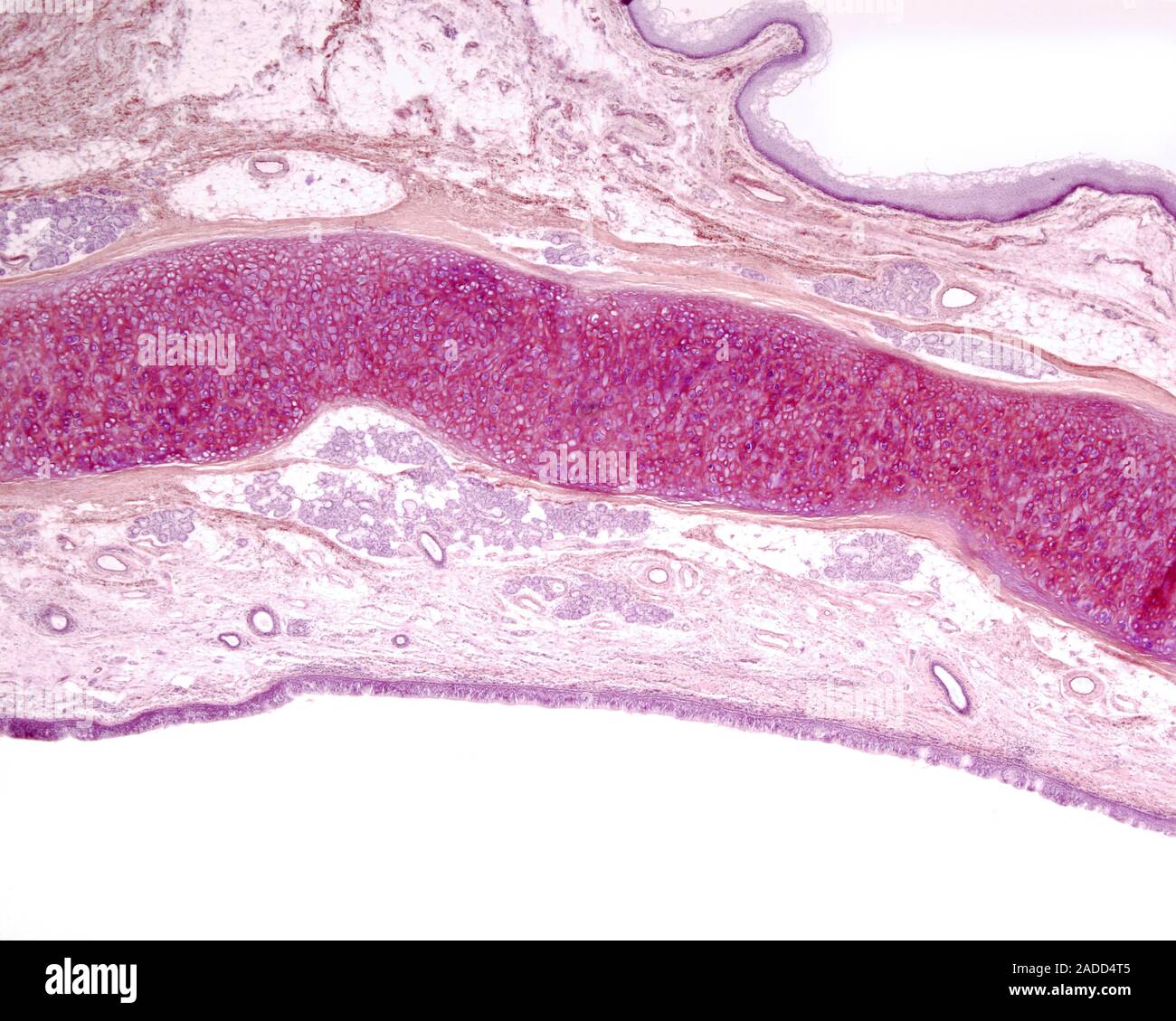Low magnification light micrograph of a human epiglottis stained with ...