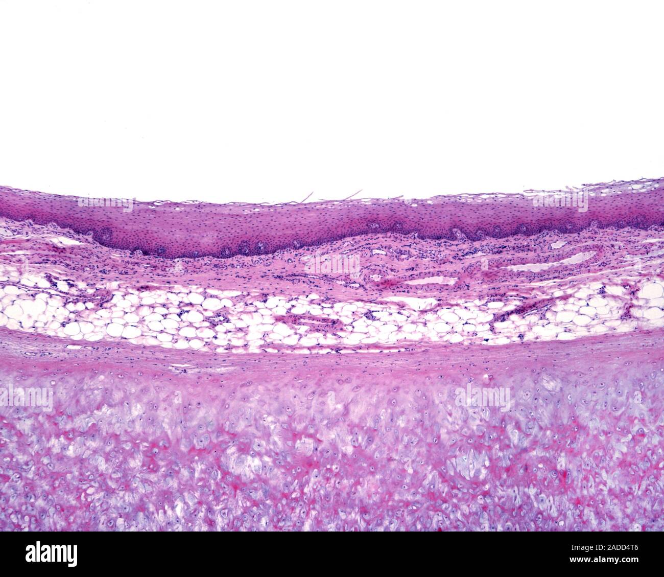 Light micrograph of the lingual surface of the epiglottis. From top to ...